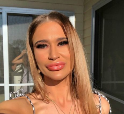 The overfilled face: Why the overfilled don't see - Victorian Cosmetic ...