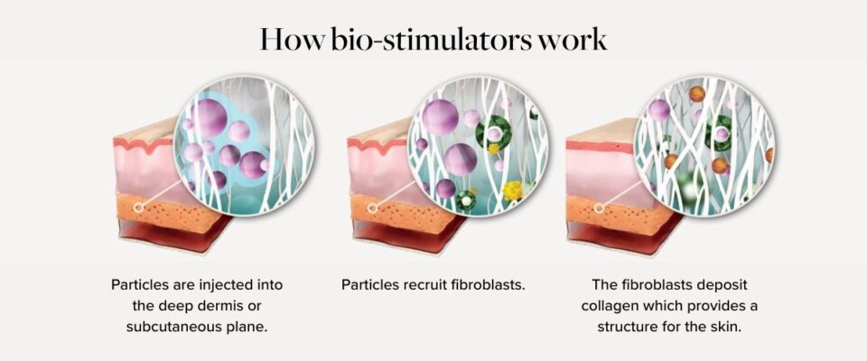Biostimulator Schematic Muscle Stimulator Boost Convertor Mu