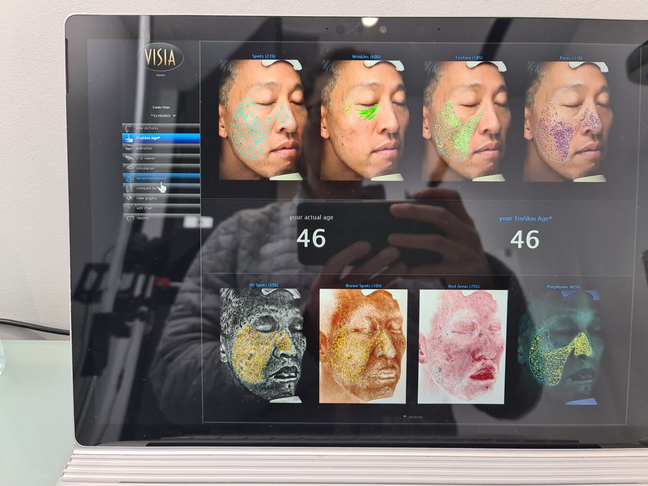 VISIA Skin Analysis - Victorian Cosmetic Institute