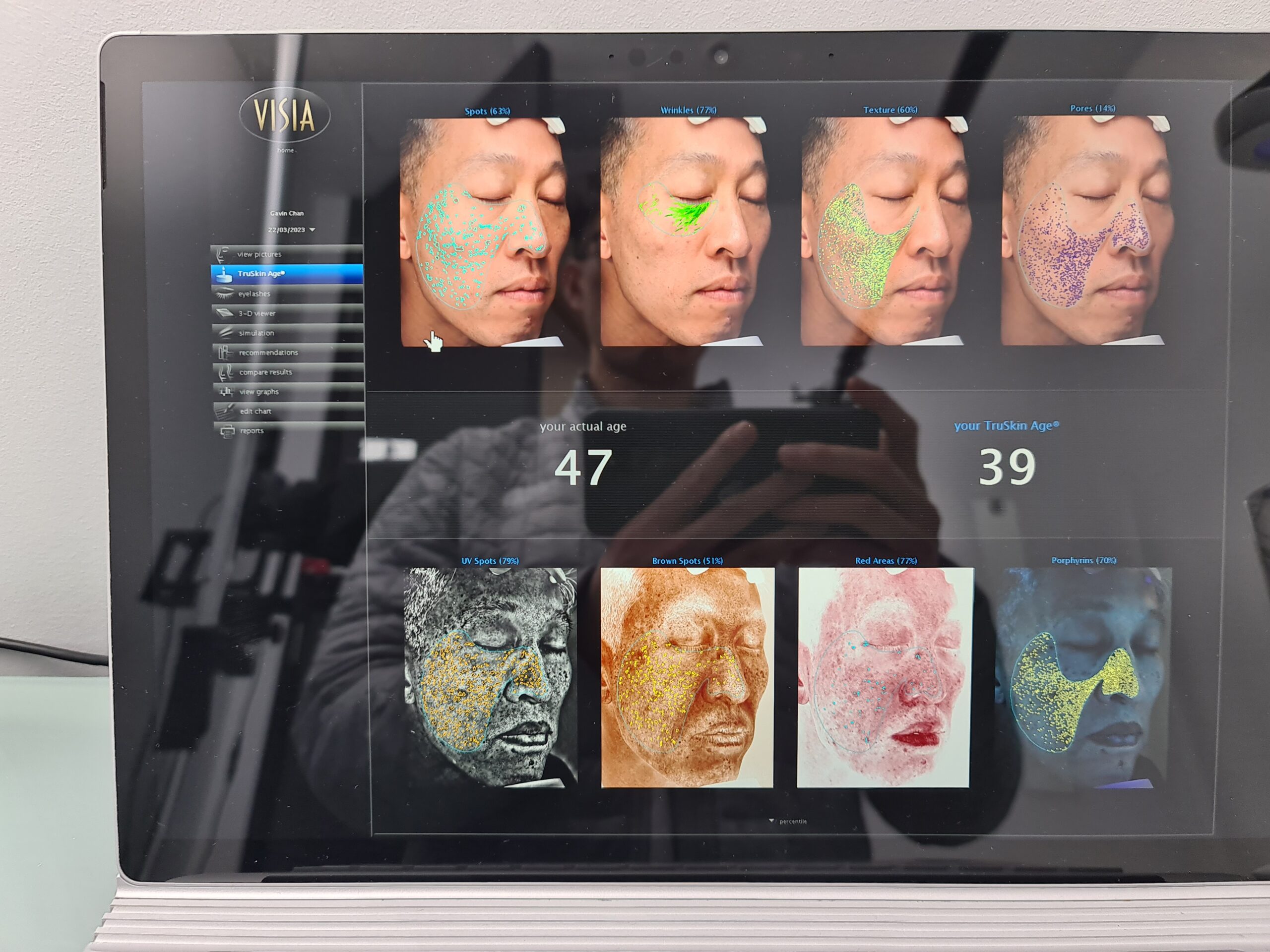 VISIA Skin Analysis - Victorian Cosmetic Institute