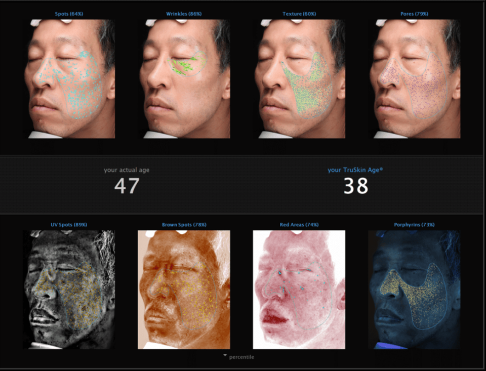 VISIA Skin Analysis | Victorian Cosmetic Institute